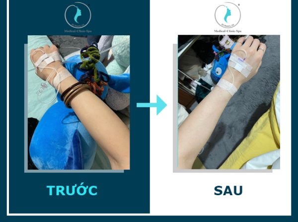 Bộ 4 sản phẩm truyền trắng S8 SAGE Lab Swiss Thụy Sĩ