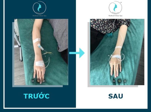 Bộ 4 sản phẩm truyền trắng S8 SAGE Lab Swiss Thụy Sĩ