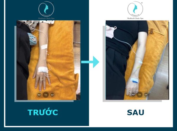 Bộ 4 sản phẩm truyền trắng S8 SAGE Lab Swiss Thụy Sĩ