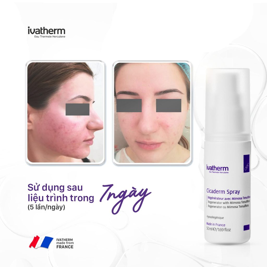 Ivatherm Cicaderm Spray Xịt tái tạo và ngăn ngừa sẹo 50ml
