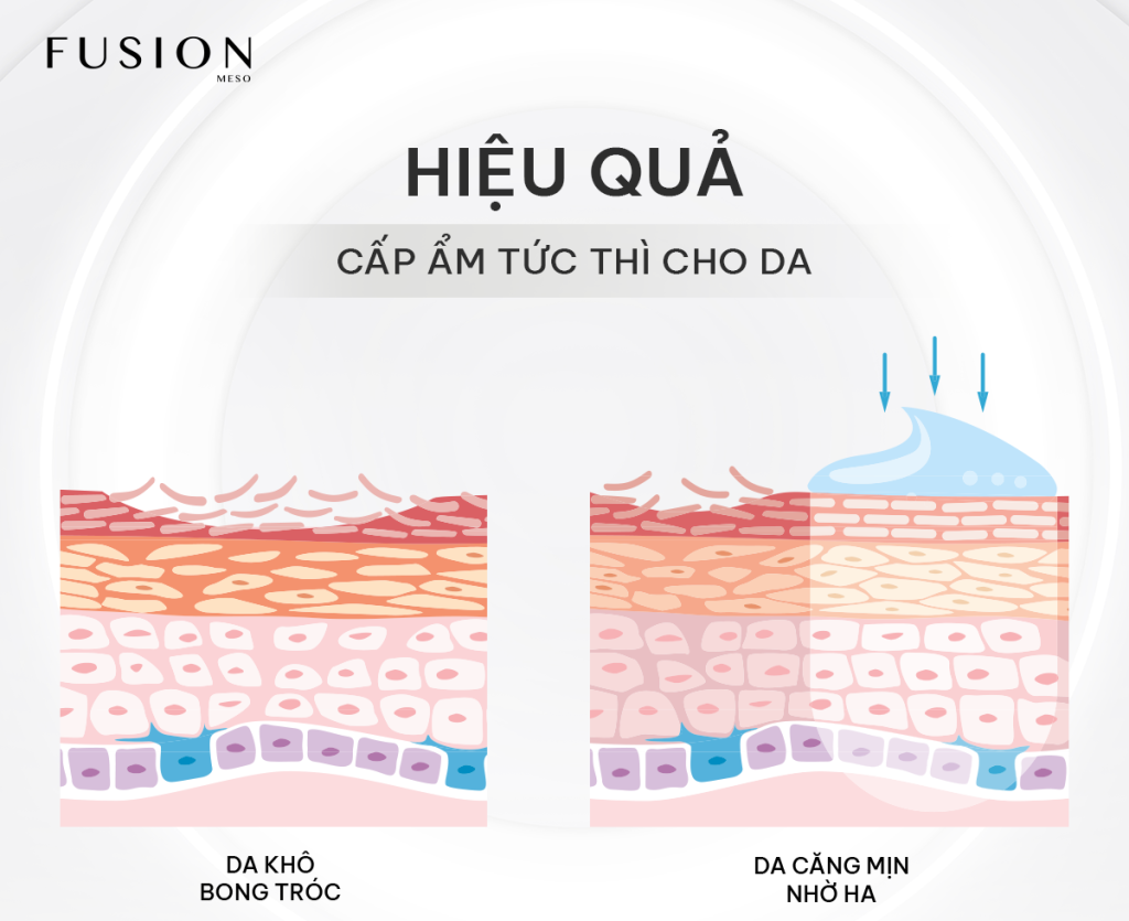LIỆU TRÌNH FUSION MESO F-HA CHO LÀN DA TRẺ HÓA CĂNG BÓNG 10ml