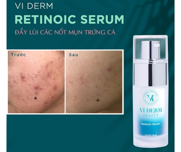 Serum Trị Mụn, Chống Lão Hóa VIDerm Retinoic 30ml
